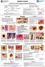 Dermoscopy | PHARMAC